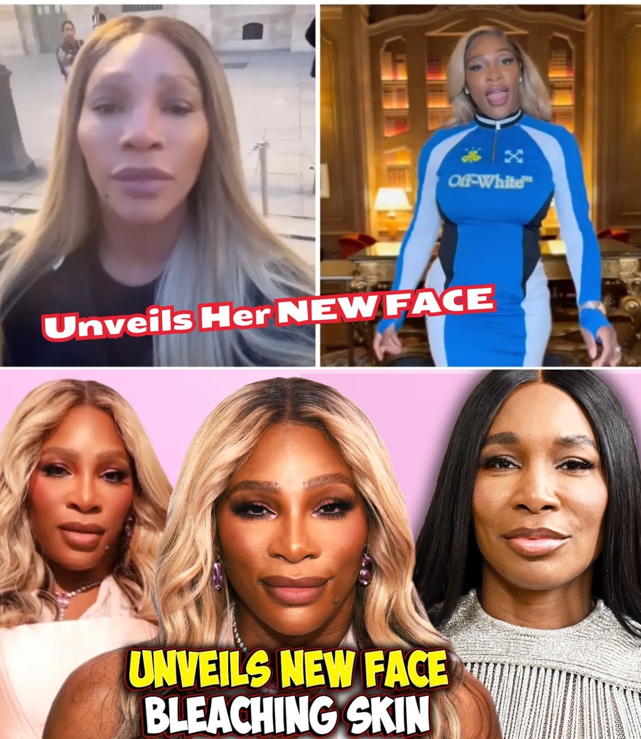 Serena Williams Unveils Her NEW FACE . . . X Says Got “Surgery To Look Like A WHITE Woman’!! - News